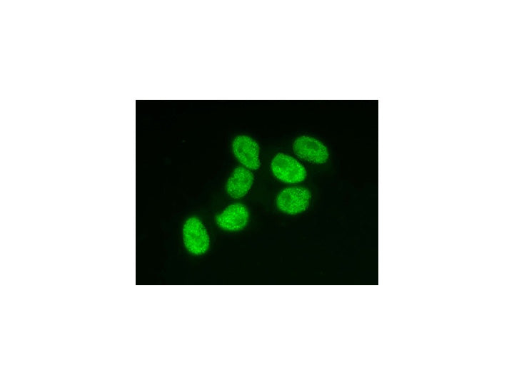 Anti-INI1/BAF47/hSNF5 mAb( 2C2 )[ CEC-037 ] | Antibodies Collection ...