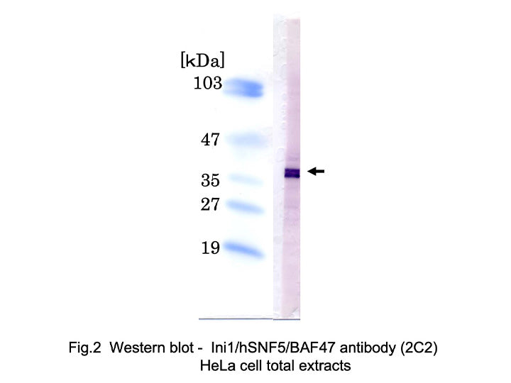 Anti-INI1/BAF47/hSNF5 mAb( 2C2 )[ CEC-037 ] | Antibodies Collection ...