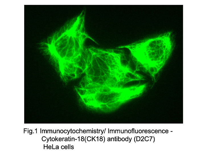 Anti-Cytokeratin18 (CK18) mAb( D2C7 )[ CEC-046 ] | Antibodies ...