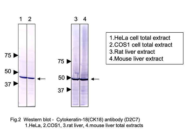 Anti-Cytokeratin18 (CK18) mAb( D2C7 )[ CEC-046 ] | Antibodies ...